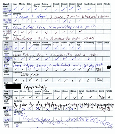 Monitoring the neurological complications of chimeric antigen receptor ...